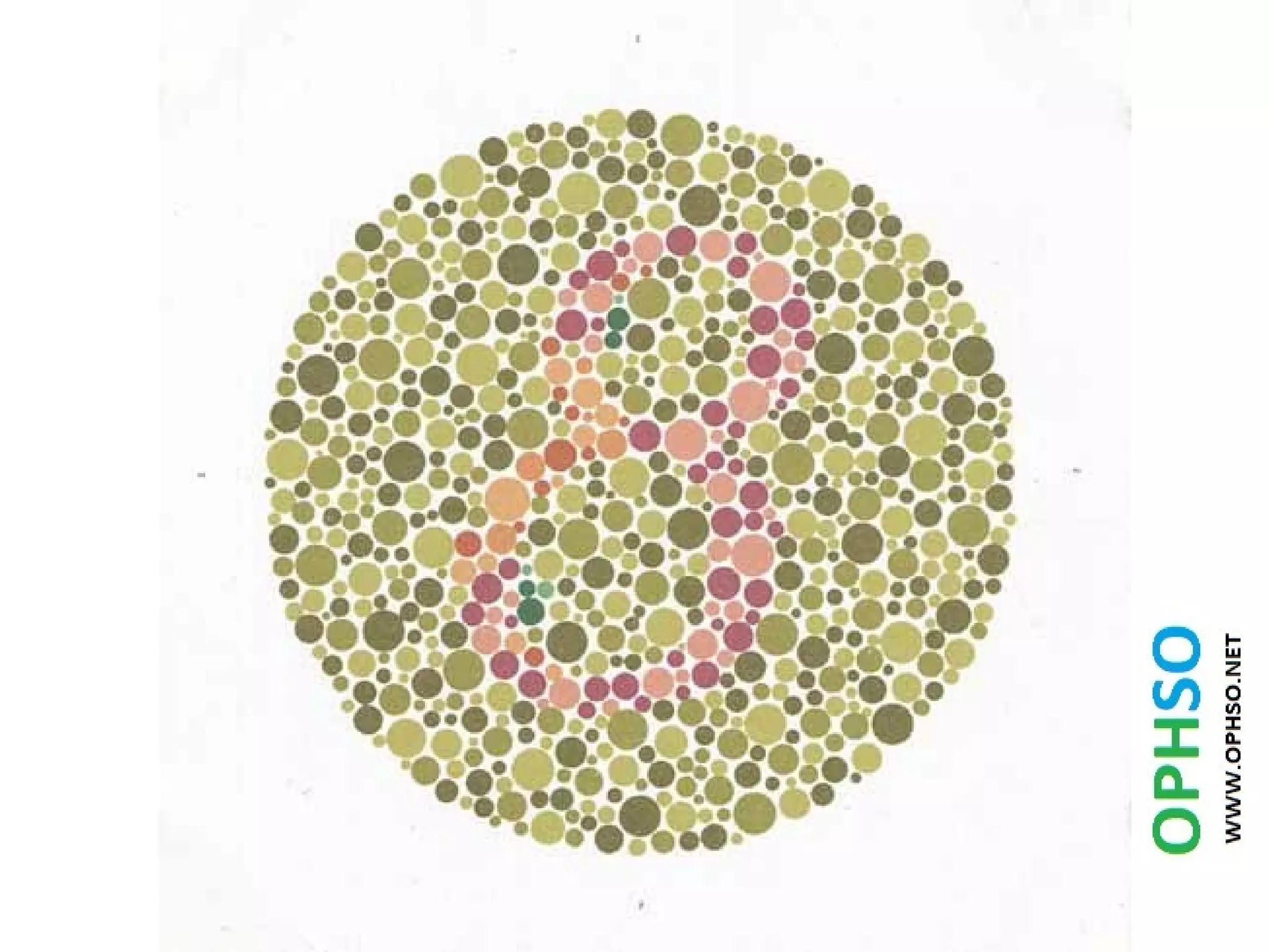 Ishihara test | PPT