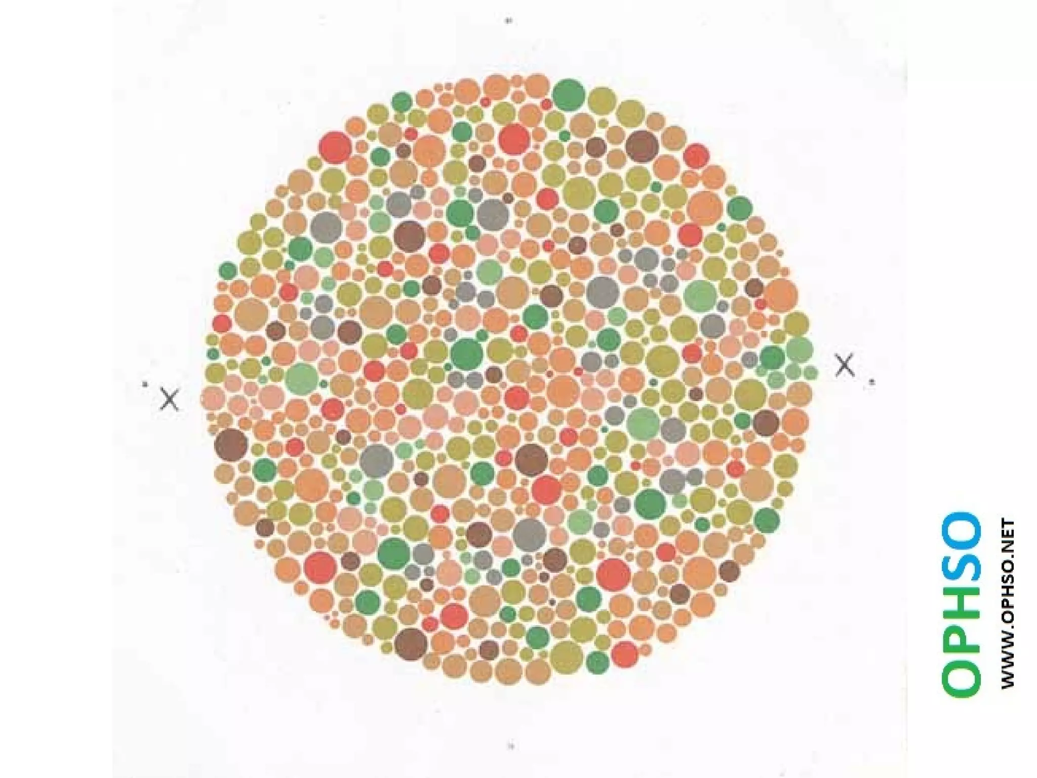 Ishihara test | PPT