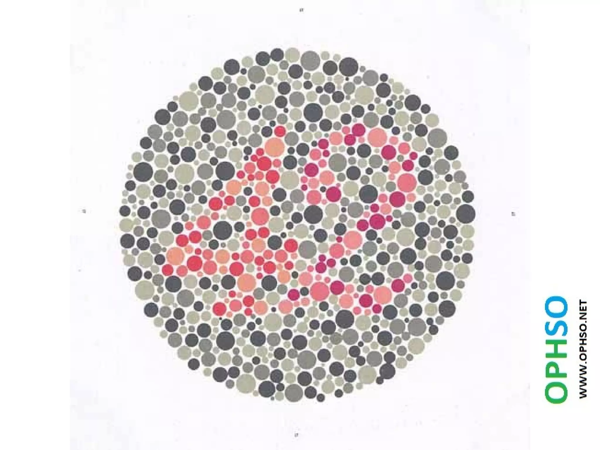 Ishihara test | PPT