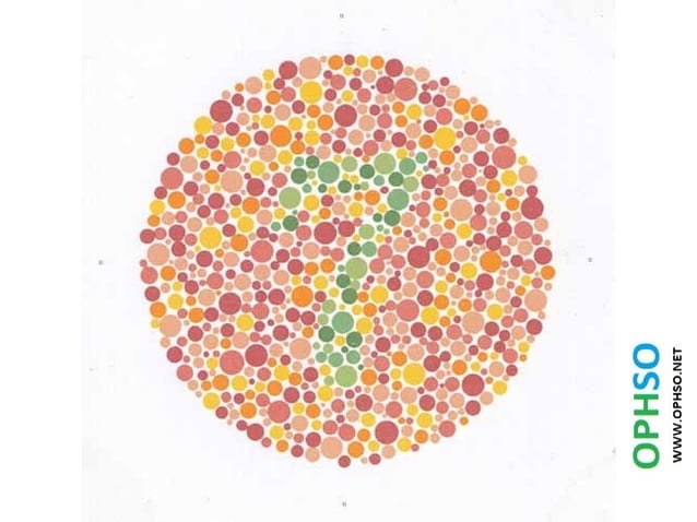 Ishihara test | PPT