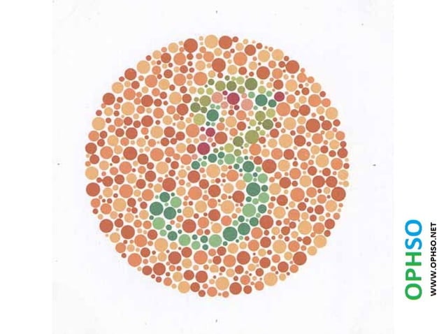 Ishihara test | PPT