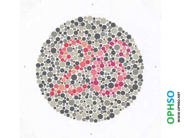 Ishihara test | PPT