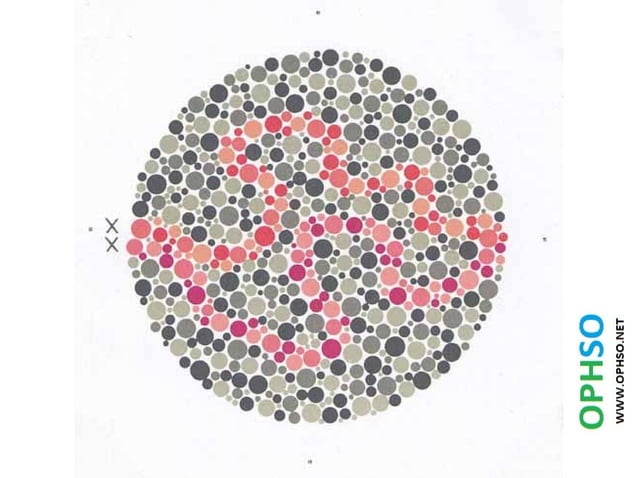 Ishihara test | PPT