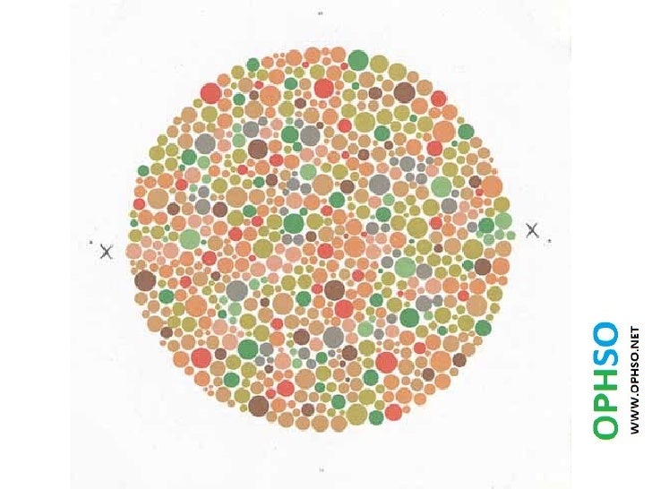 Ishihara test
