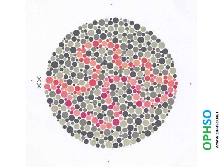 Ishihara test