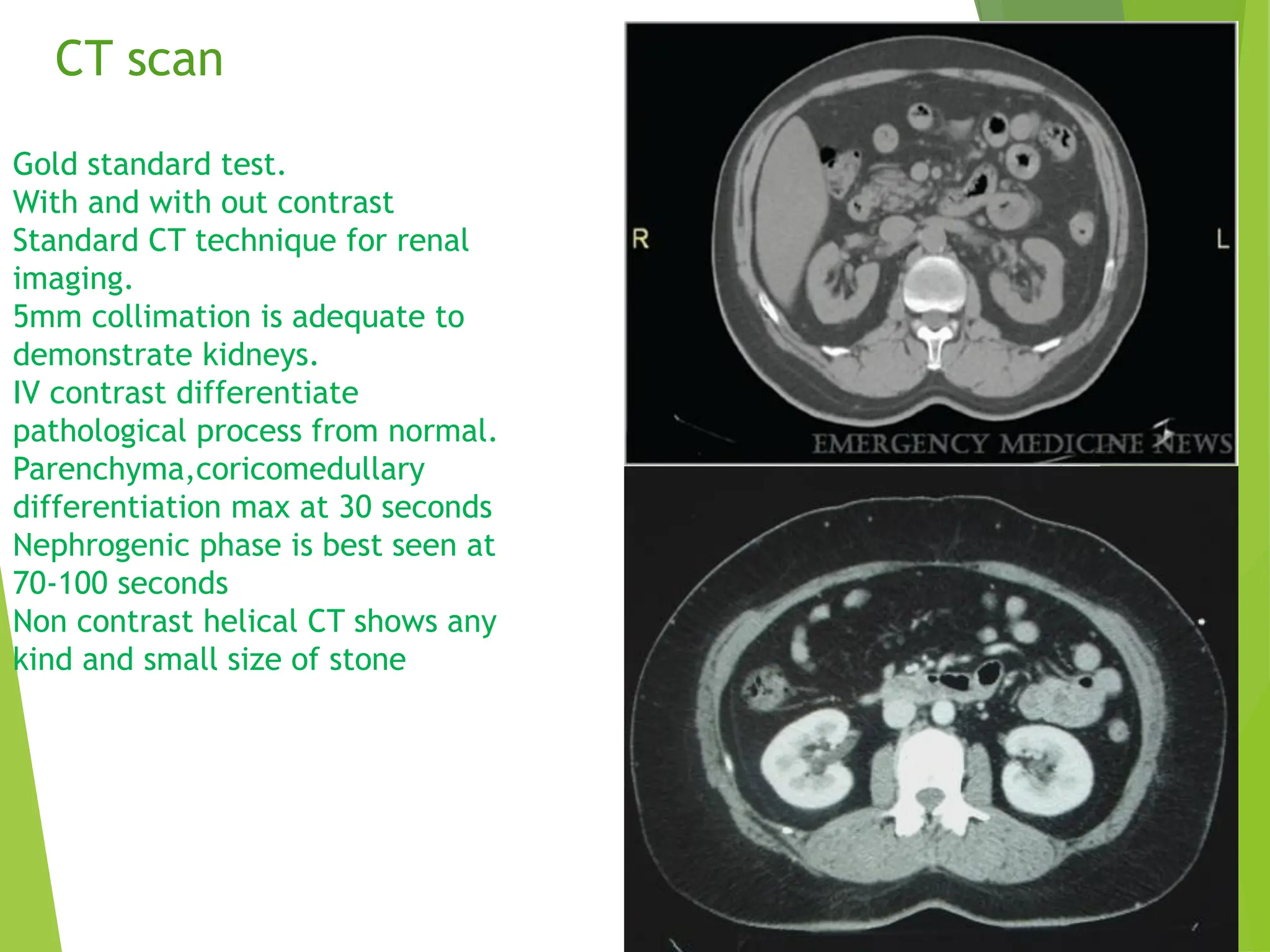 Radiology of urology | PDF