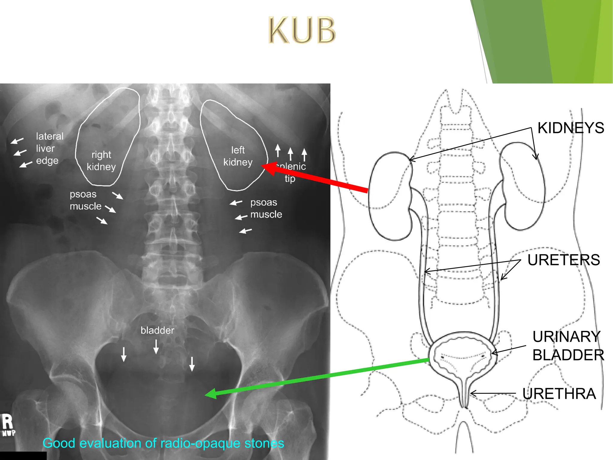 Radiology of urology | PDF