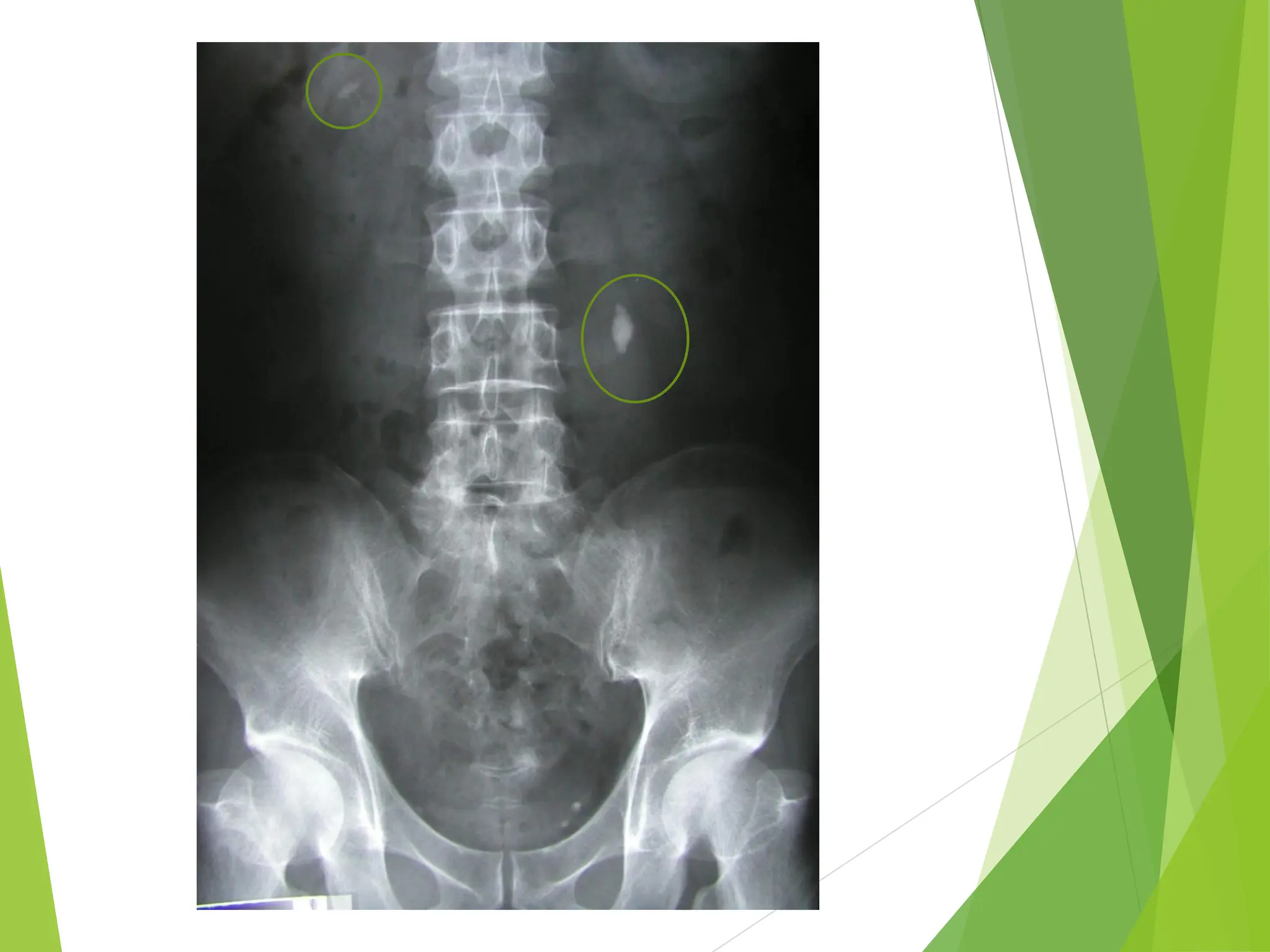 Radiology of urology | PDF