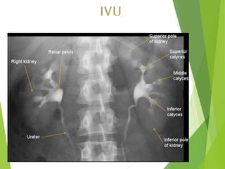 Radiology of urology | PDF | Medical Tests | Medical Health