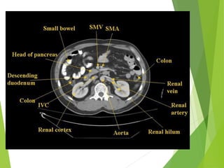 Radiology of urology | PDF | Medical Tests | Medical Health