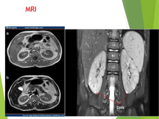 Radiology of urology | PDF | Medical Tests | Medical Health