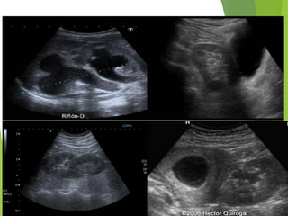 Radiology of urology | PDF | Medical Tests | Medical Health