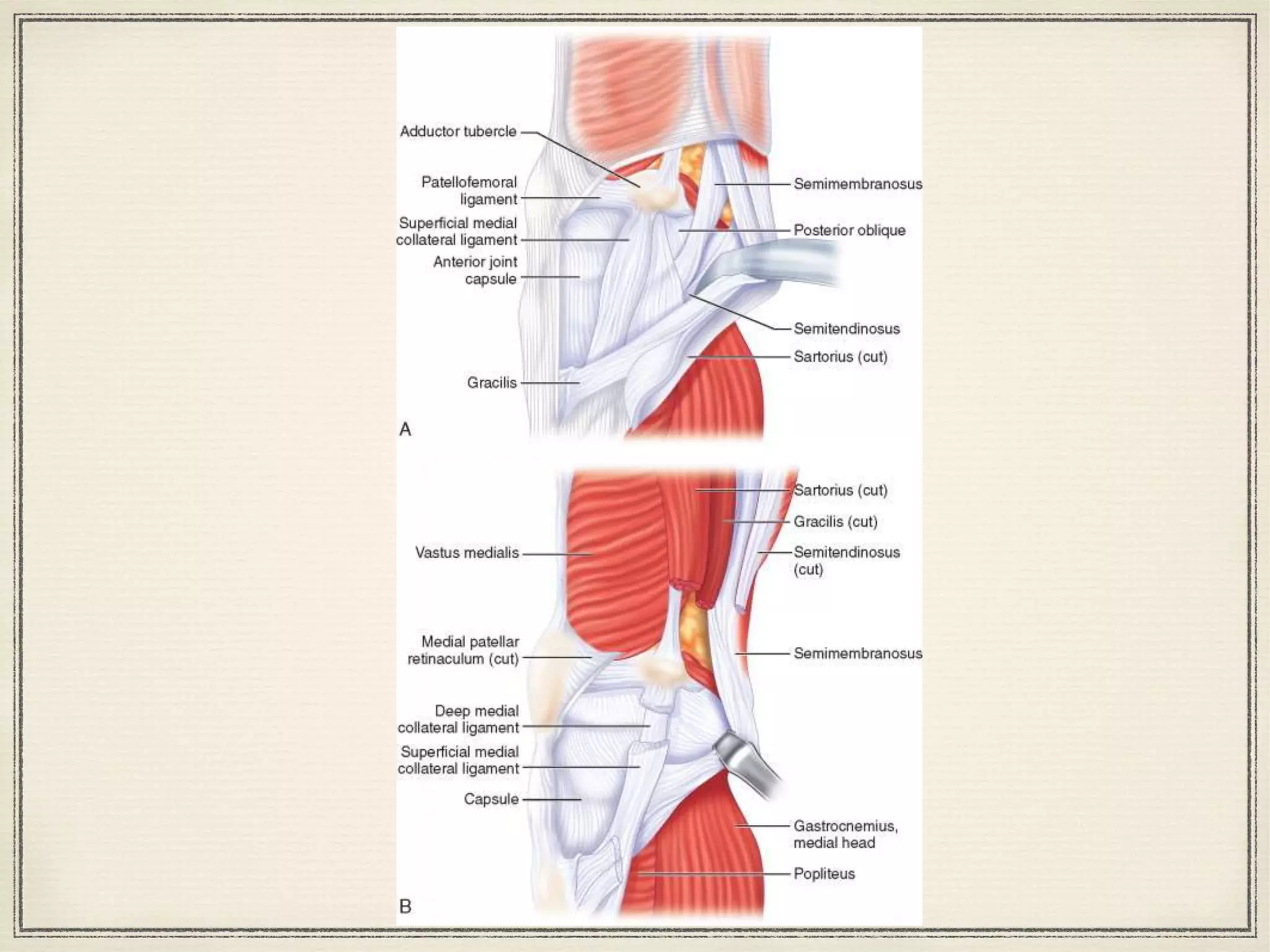 Algorithm to correct Varus Knee in a TKR | PPTX