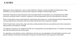 Phototoxicity / Phototoxicity testing | PPT