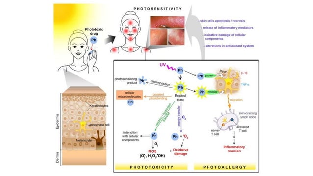Phototoxicity / Phototoxicity testing | PPT