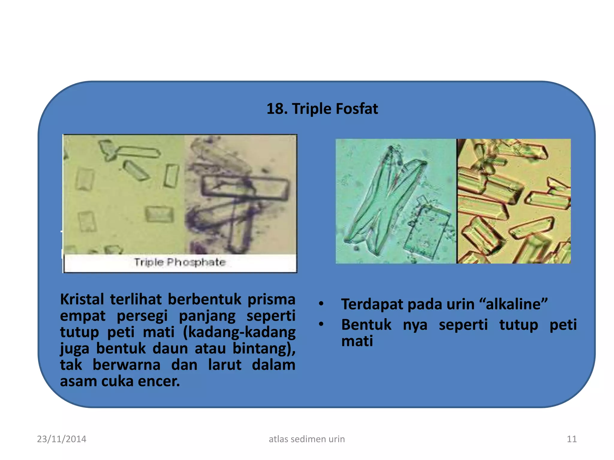 Isi atlas sedimen urin | PPTX