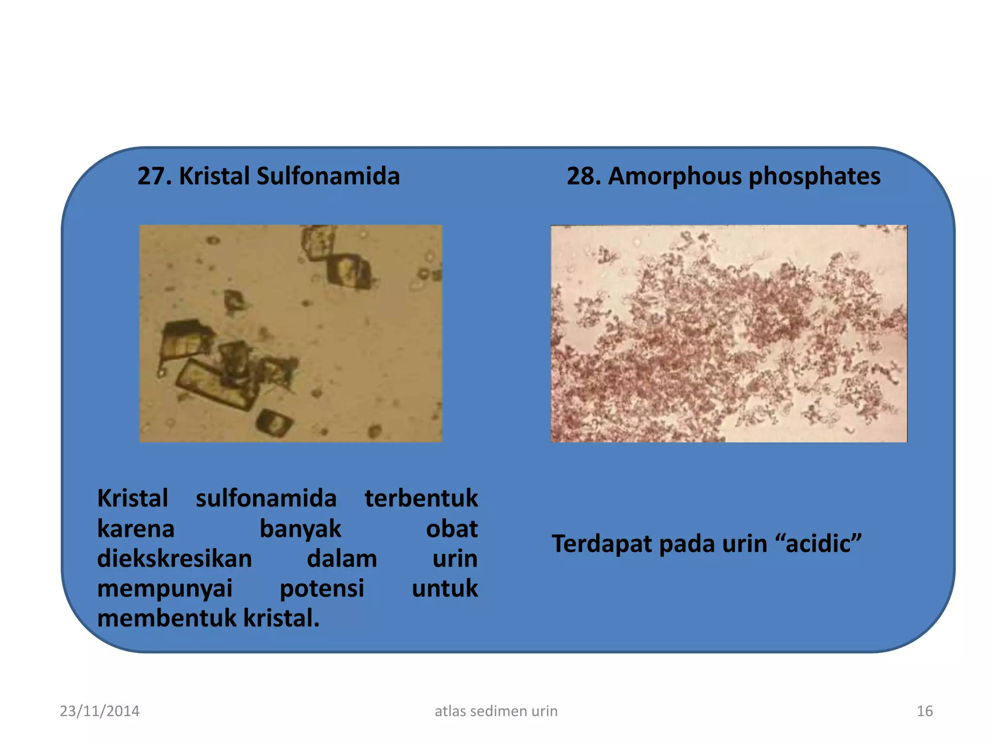Isi atlas sedimen urin | PPTX