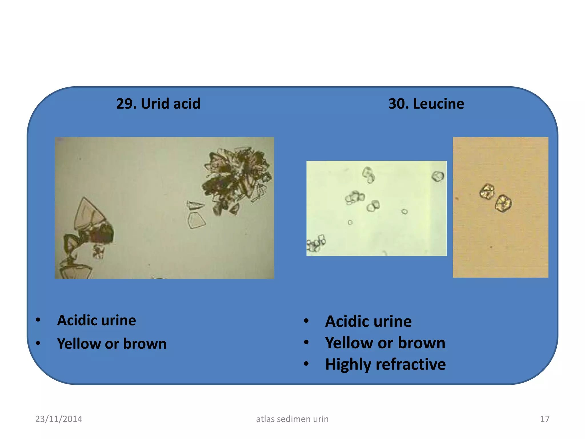 Isi atlas sedimen urin | PPTX