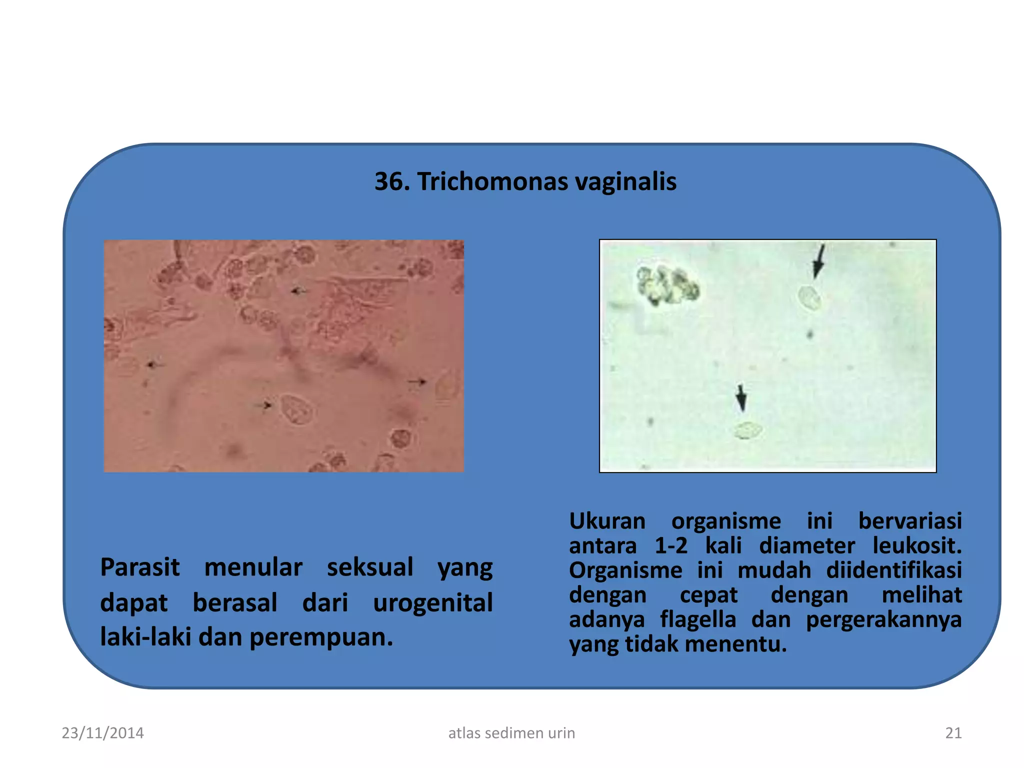 Isi atlas sedimen urin | PPTX