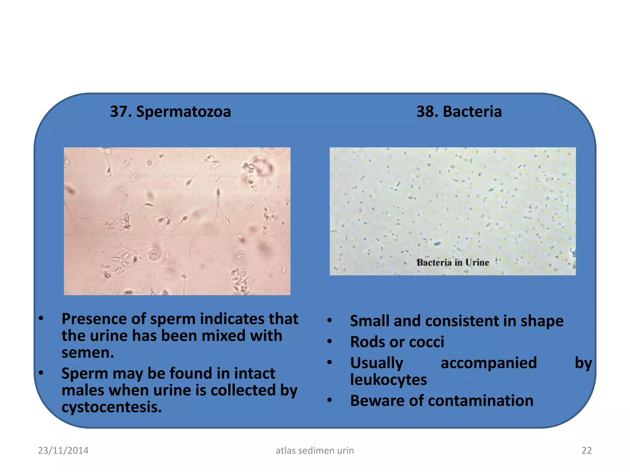Isi atlas sedimen urin | PPTX