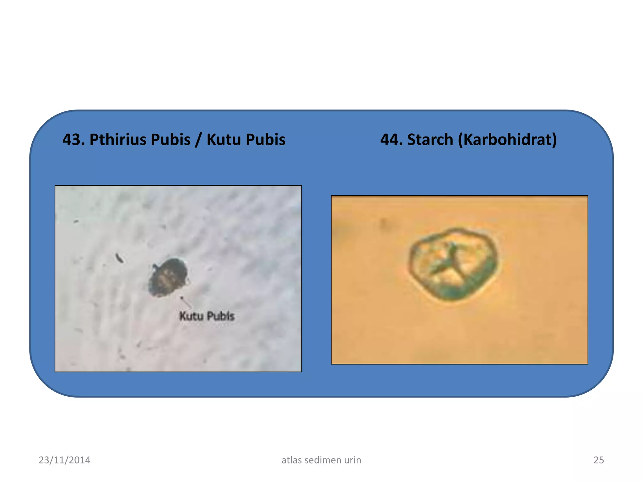 Isi atlas sedimen urin | PPTX