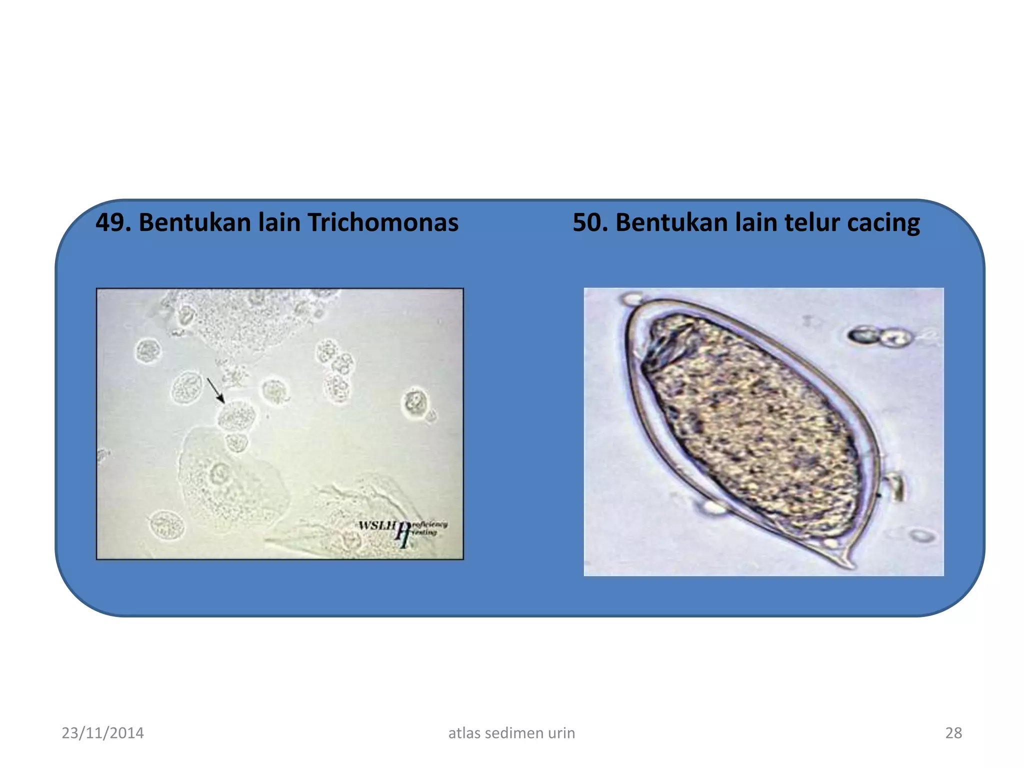 Isi atlas sedimen urin | PPTX