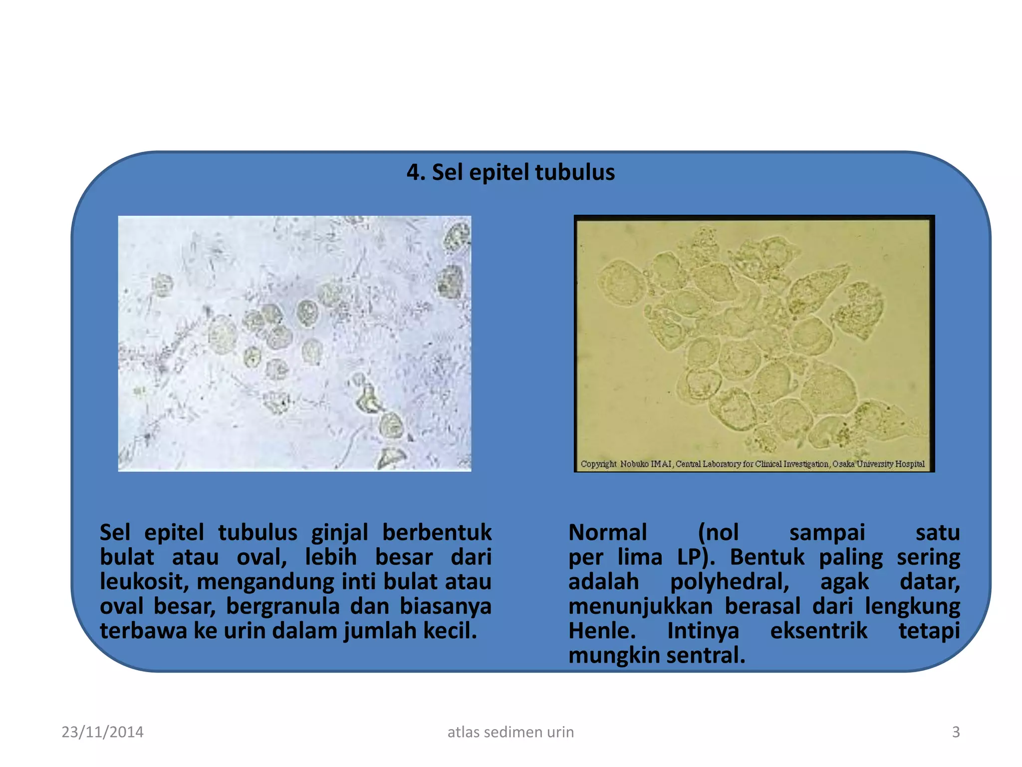 Isi atlas sedimen urin | PPTX