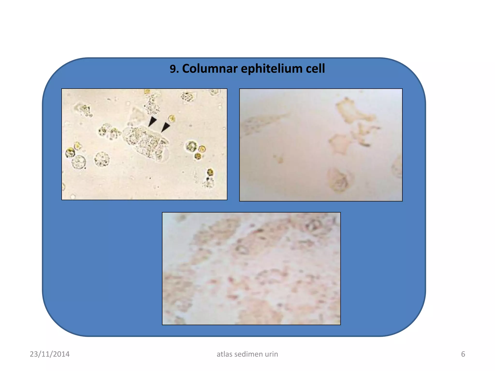 Isi atlas sedimen urin | PPTX