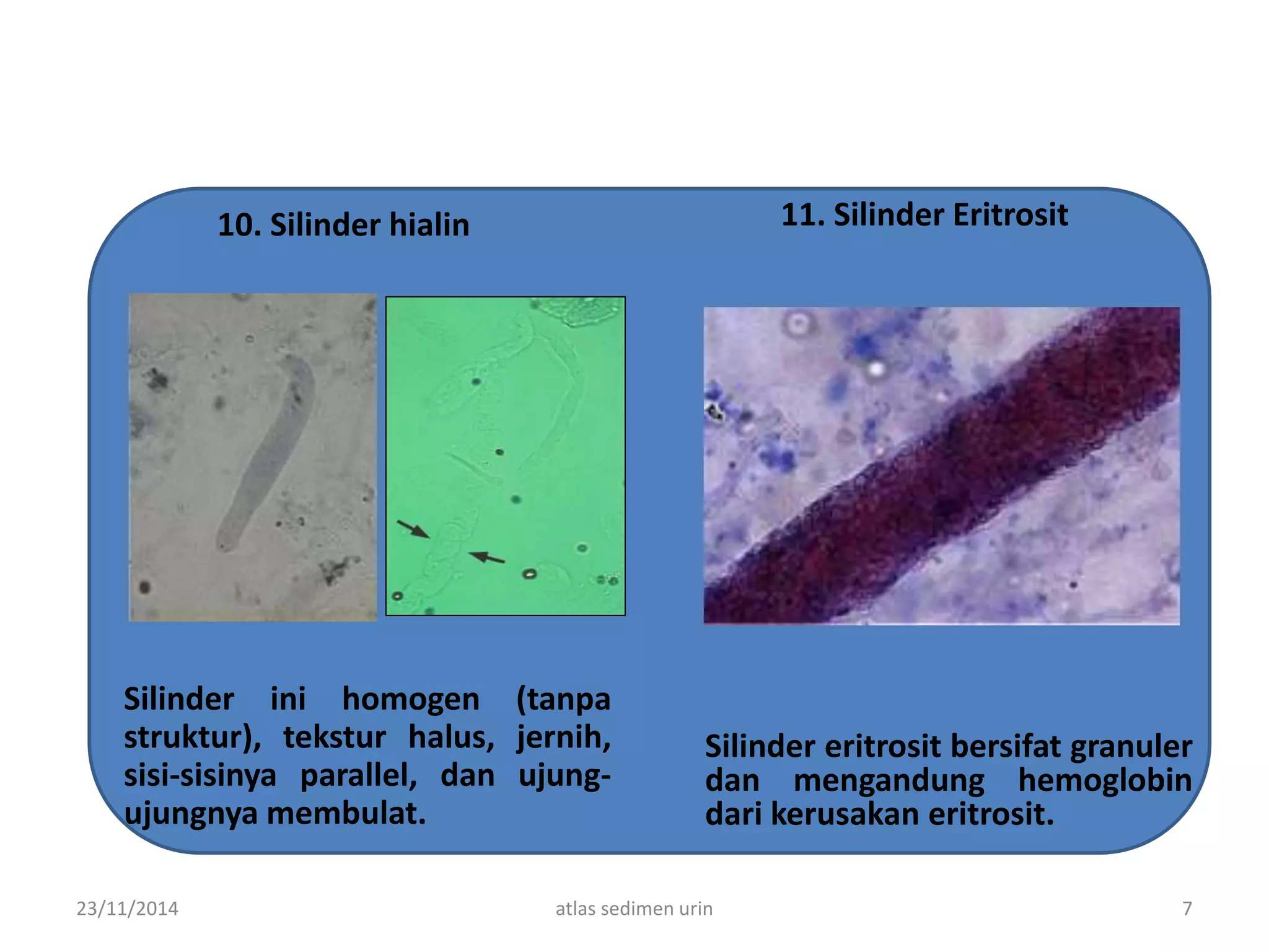 Isi atlas sedimen urin | PPTX