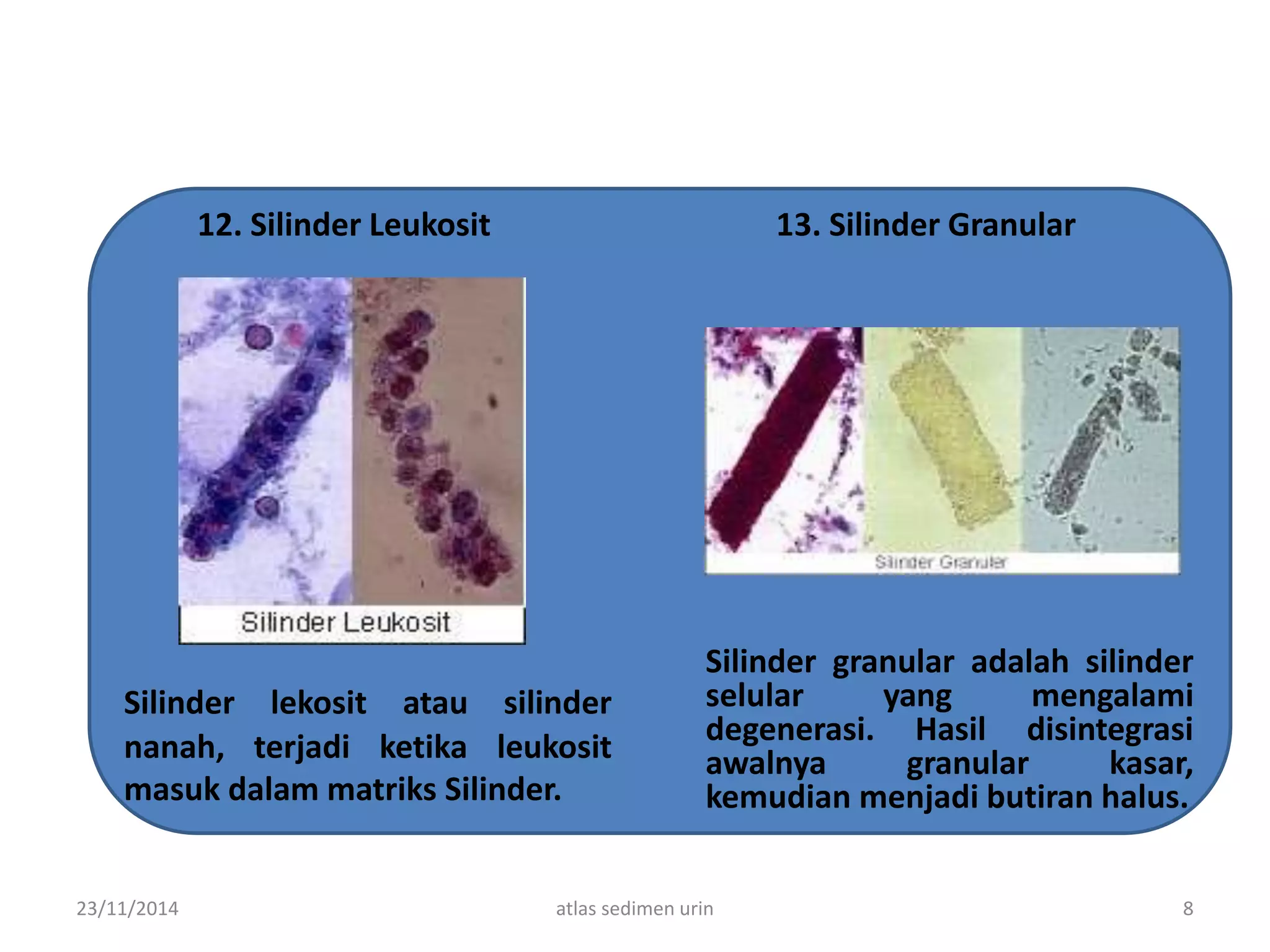 Isi atlas sedimen urin | PPTX