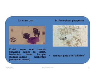 Isi atlas sedimen urin | PPTX