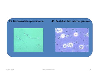 Isi atlas sedimen urin | PPTX