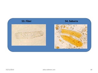 Isi atlas sedimen urin | PPTX
