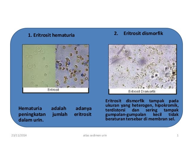 Isi atlas sedimen urin