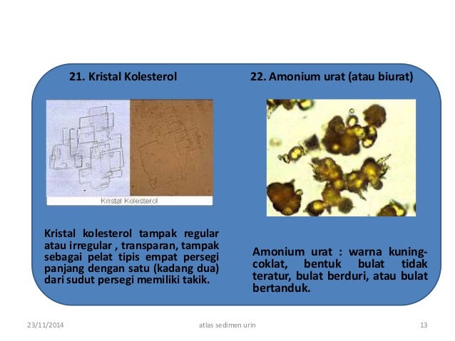 Isi atlas sedimen urin