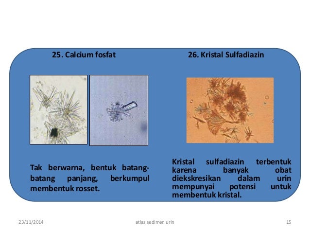 Isi atlas sedimen urin