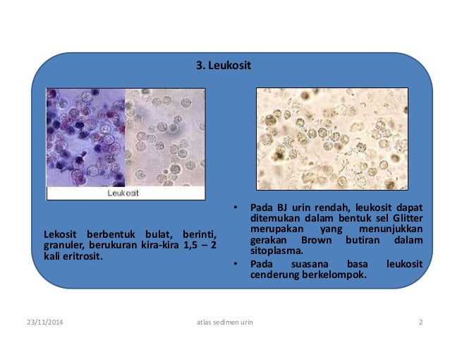 Isi atlas sedimen urin