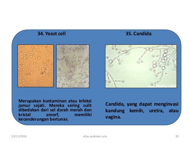 Isi atlas sedimen urin