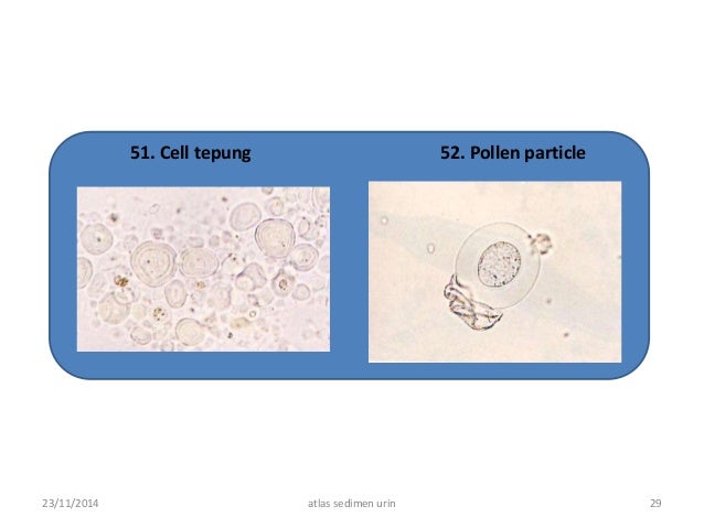 Isi atlas sedimen urin