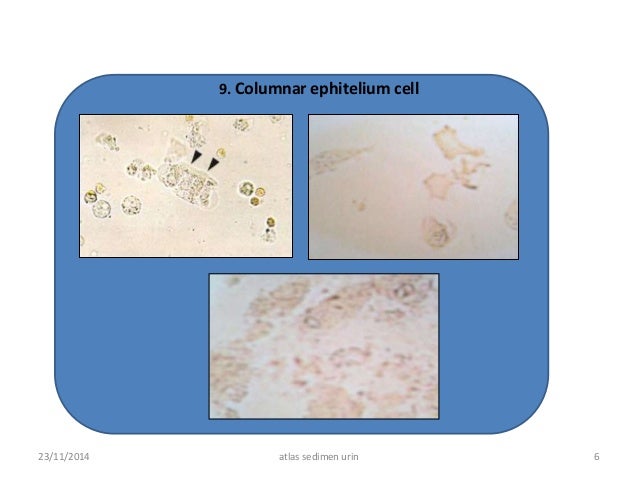 Isi atlas sedimen urin