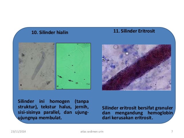 Isi atlas sedimen urin