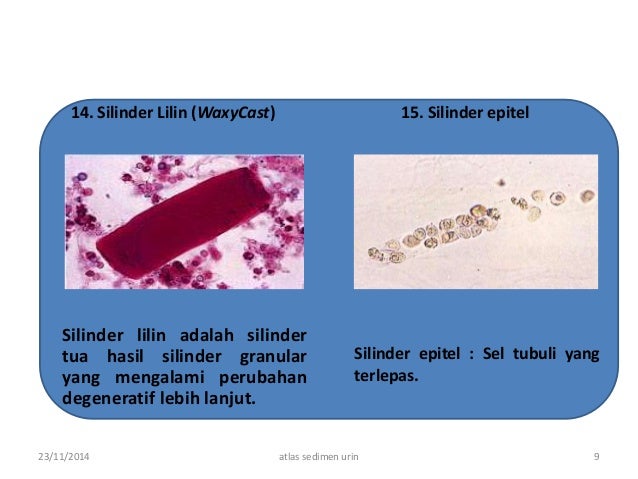 Isi atlas sedimen urin