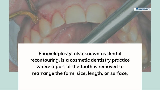 Is it Safe to Undergo an Enameloplasty Procedure | PPTX