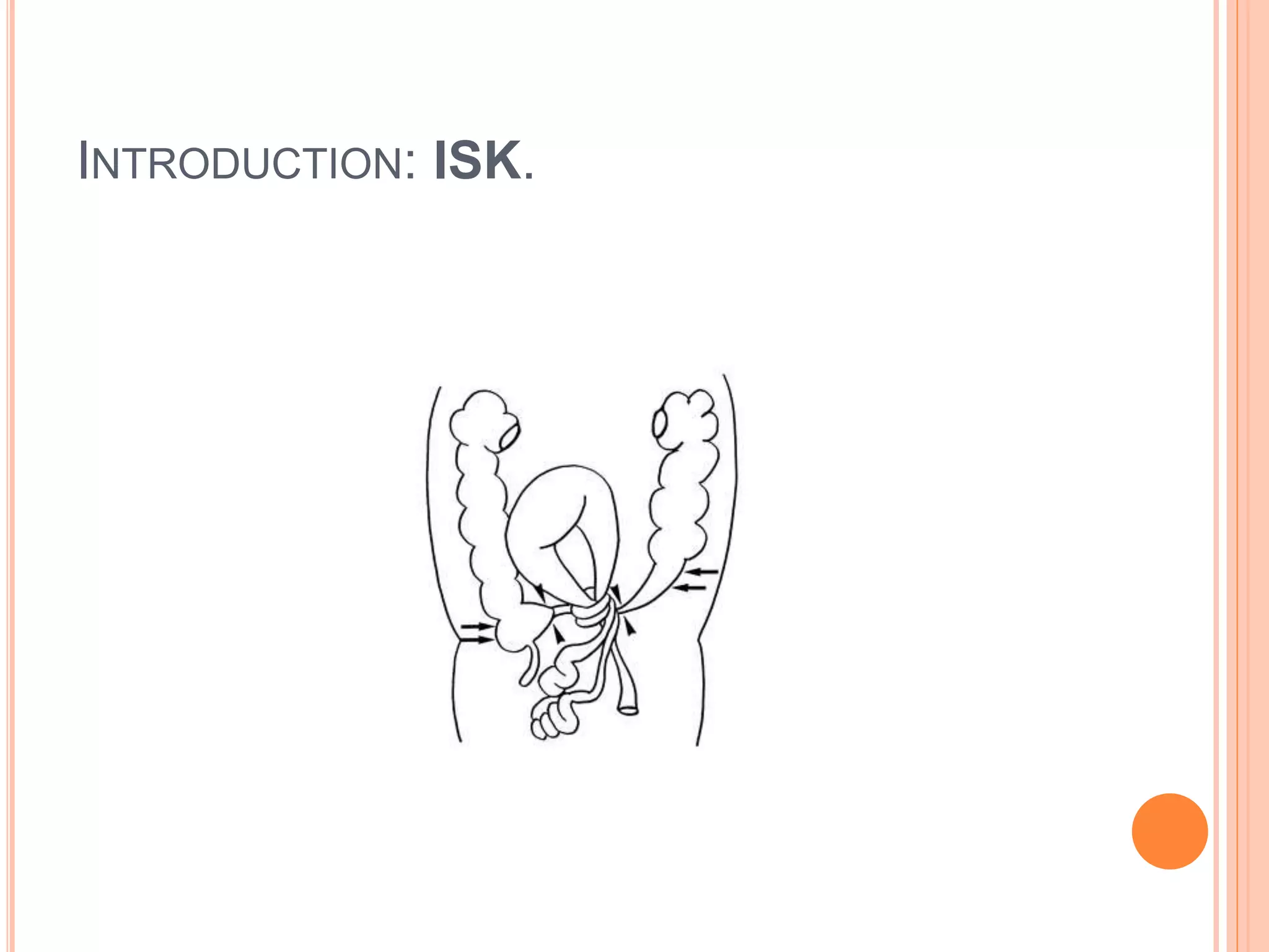Ileo-sigmoid Knotting | PPTX