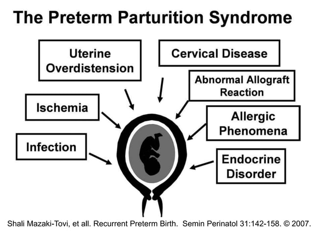 PRETERM EYLEM-DOĞUM | PDF