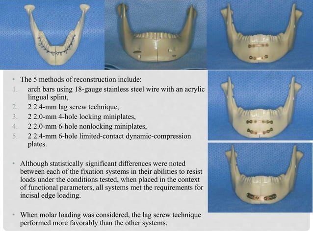 Is lag screw fixation superior to plate fixation to treat fractures of ...