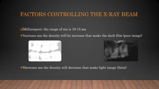 factor affecting quality of radiograph | PPTX