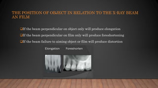 factor affecting quality of radiograph | PPTX