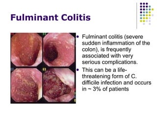 clostridium difficile by Ismail surchi | PPT
