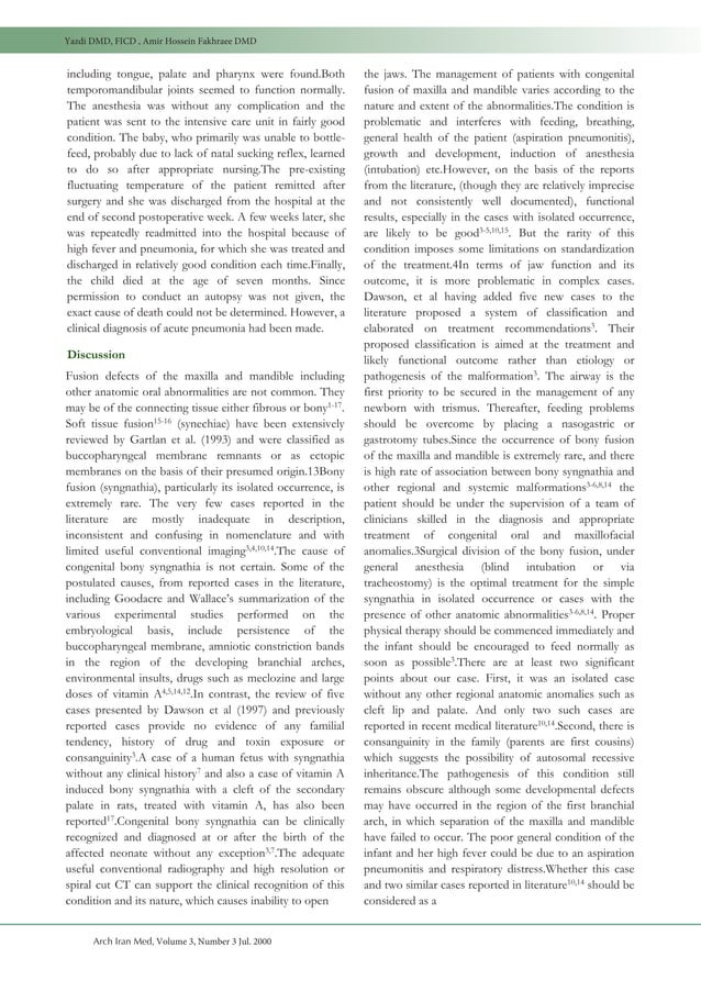 2.Ismail Yazdi anda Amir Hossein Fakhraee Congenital Fusion of Maxilla ...